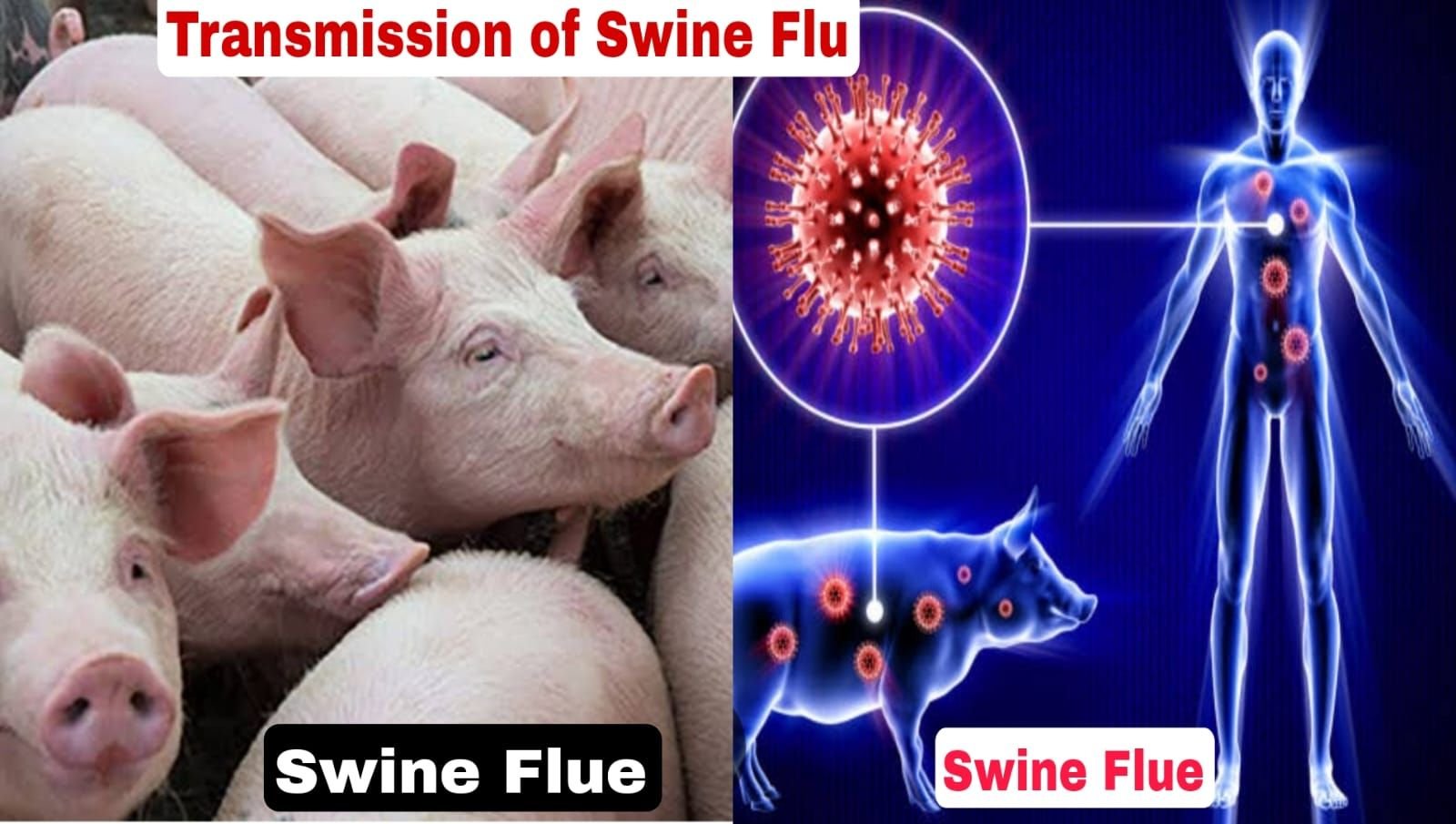 Swine Flu (H1N1), Causes, Symptoms, Diagnosis, Prevention — GS India ...